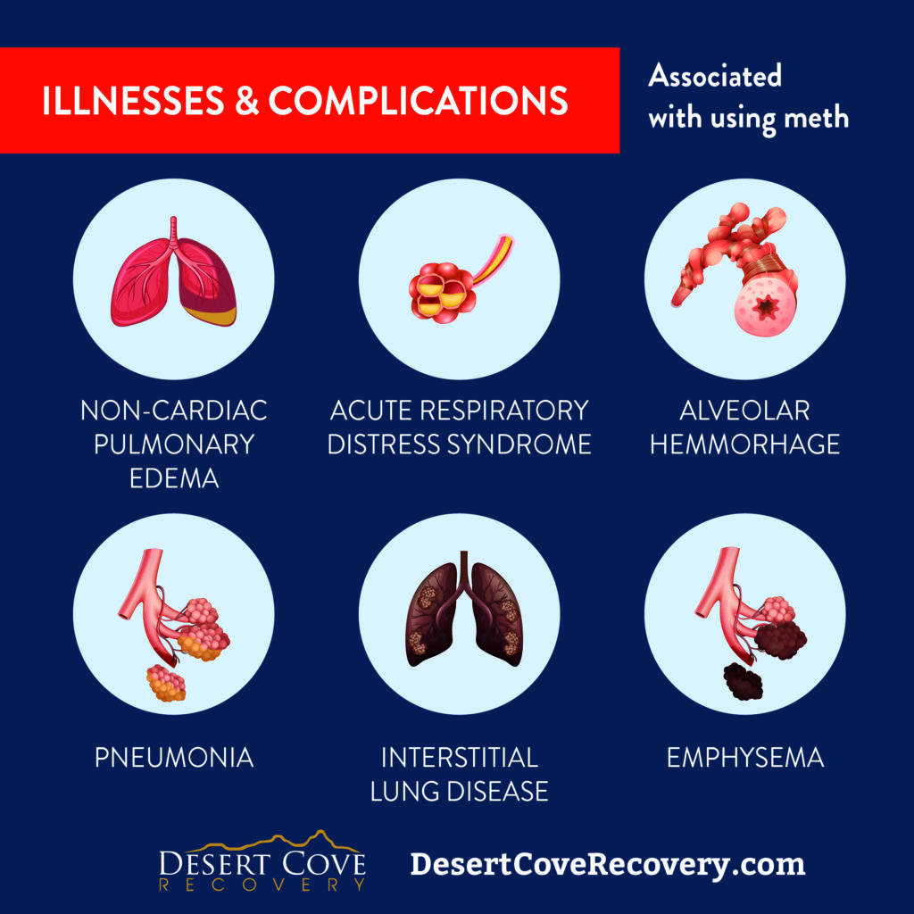 How Meth Use Affects Your Lungs - Desert Cove Recovery